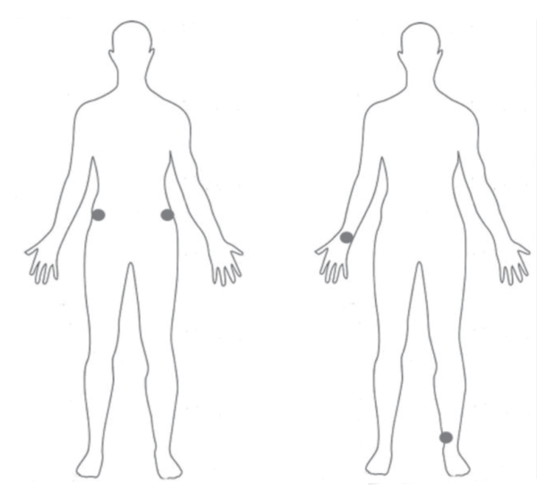 TENS Pad Placement Guide: How to Use Your HeaWea MicroGen Effectively ...